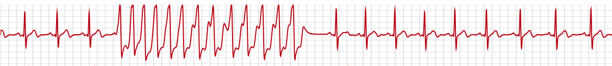 HeartBug – Australia's Friendliest Heart Monitoring Service