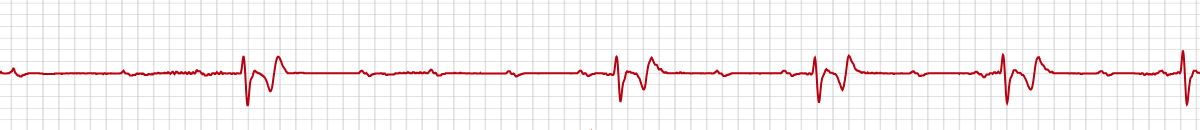 HeartBug – Australia's Friendliest Heart Monitoring Service